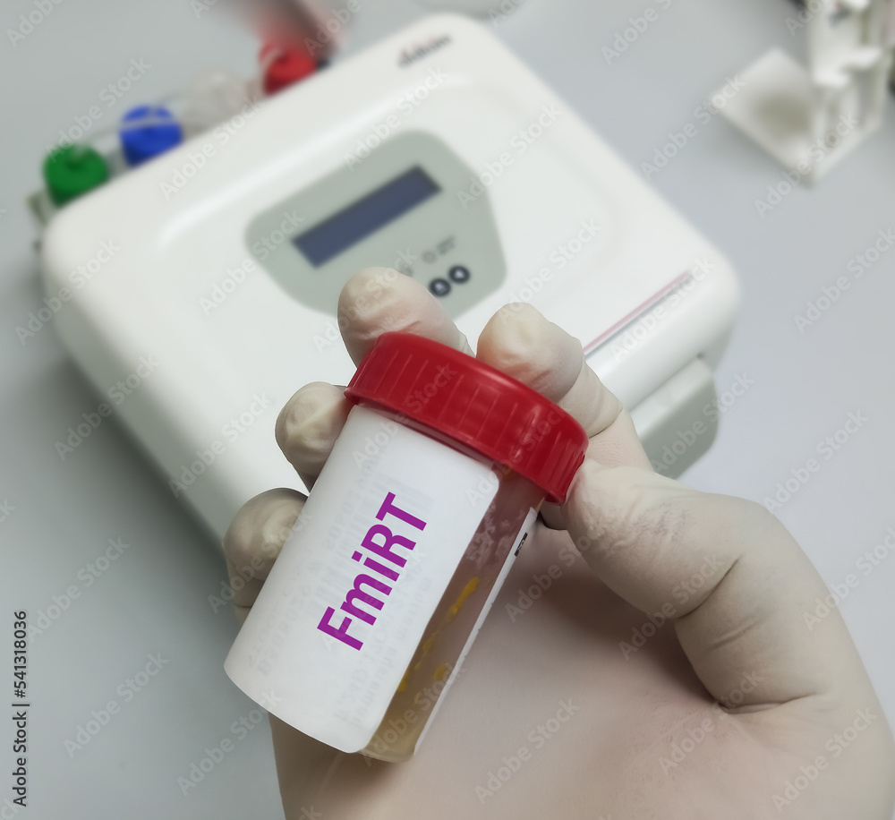 FmiRT(Fecal microRNA test). Doctor holding sample container with feces ...