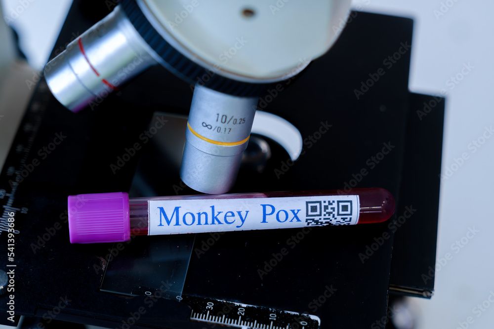 Blood test samples tube, reagent testing tube and swab collection kit ...
