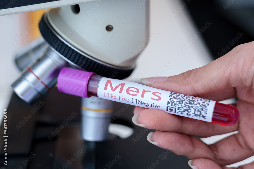 Blood test samples tube, reagent testing tube and swab collection kit ...