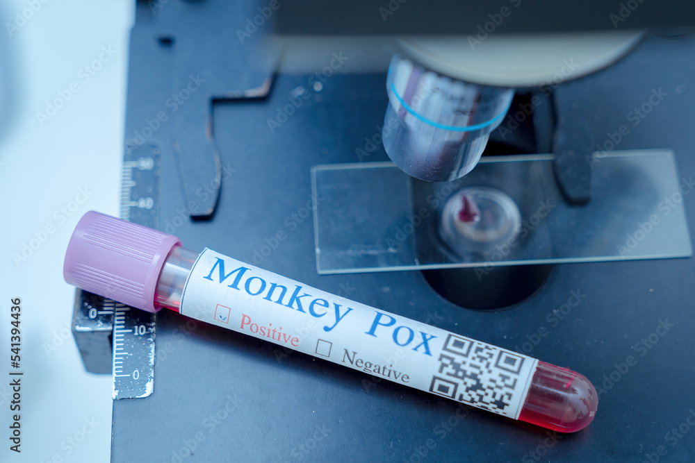 Blood test samples tube, reagent testing tube and swab collection kit ...