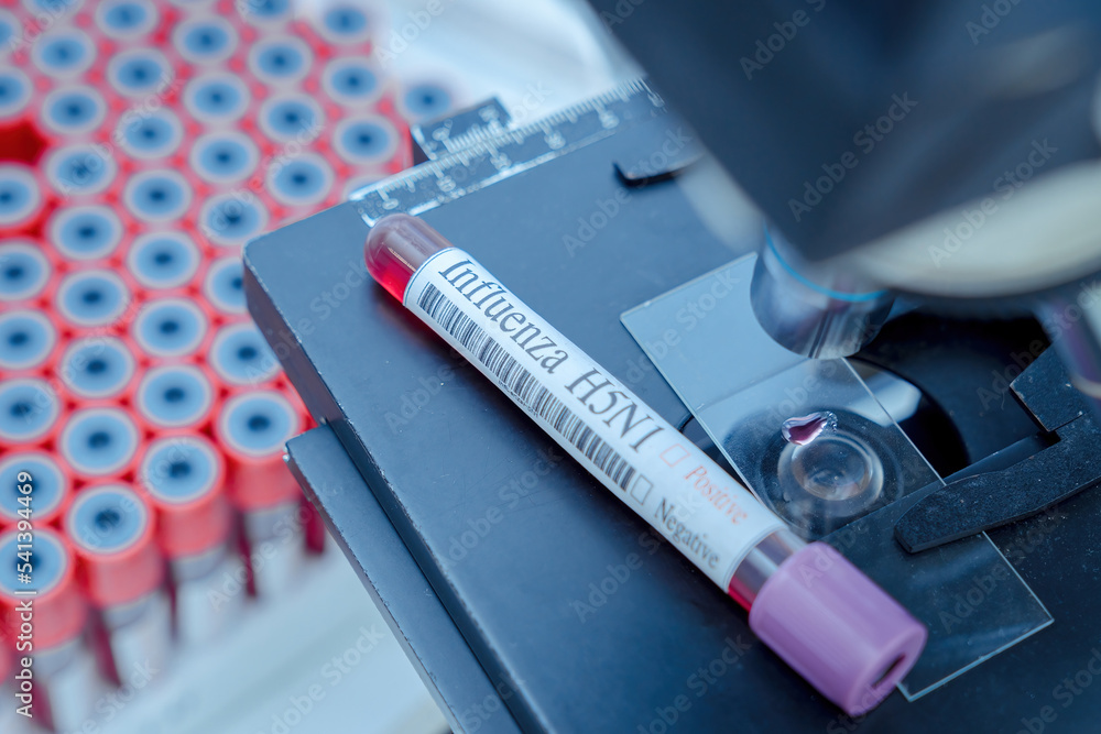 Blood test samples tube, reagent testing tube and swab collection kit ...