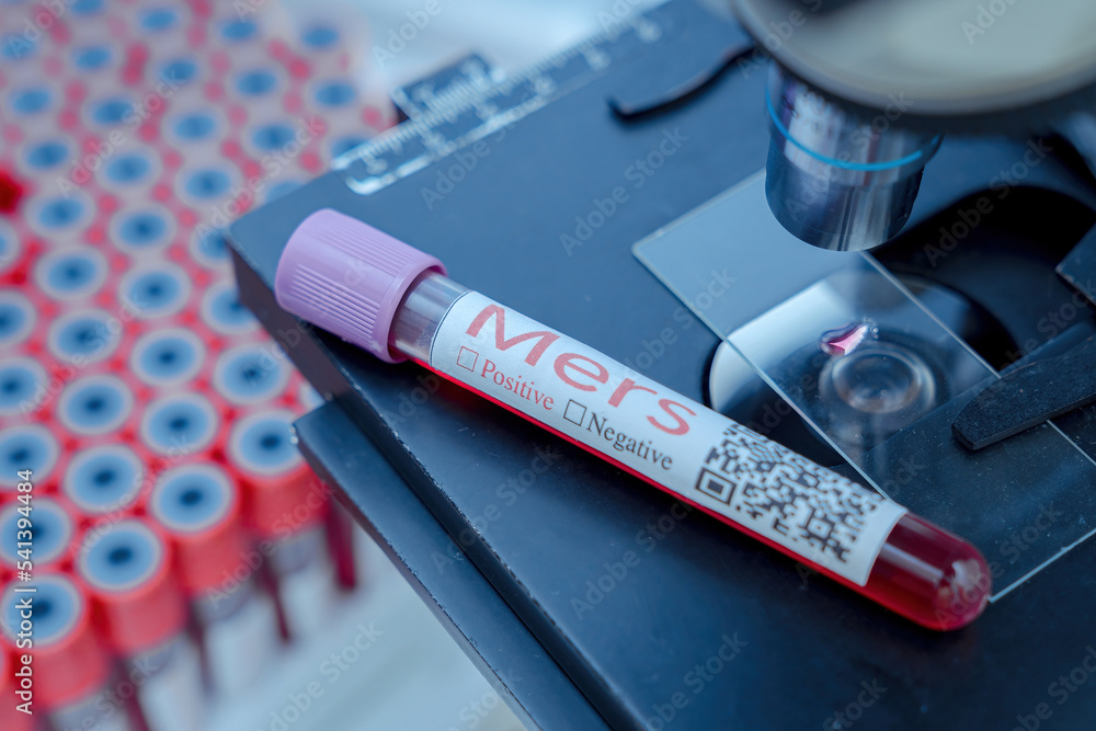 Blood test samples tube, reagent testing tube and swab collection kit ...