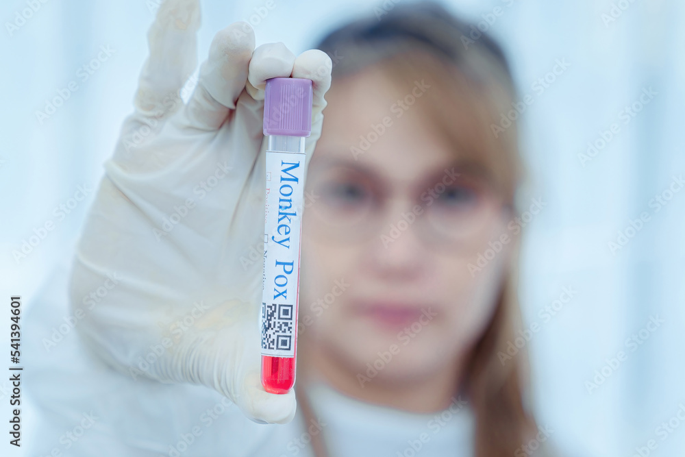 Monkey pox PCR test tube in doctors hand, medical worker in face mask ...