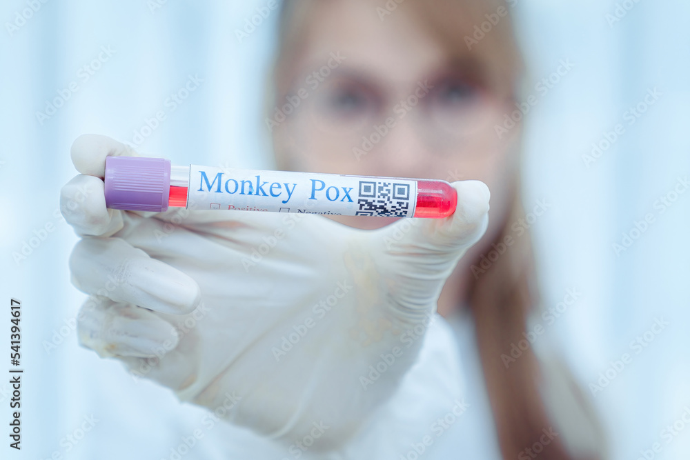 Monkey pox PCR test tube in doctors hand, medical worker in face mask ...