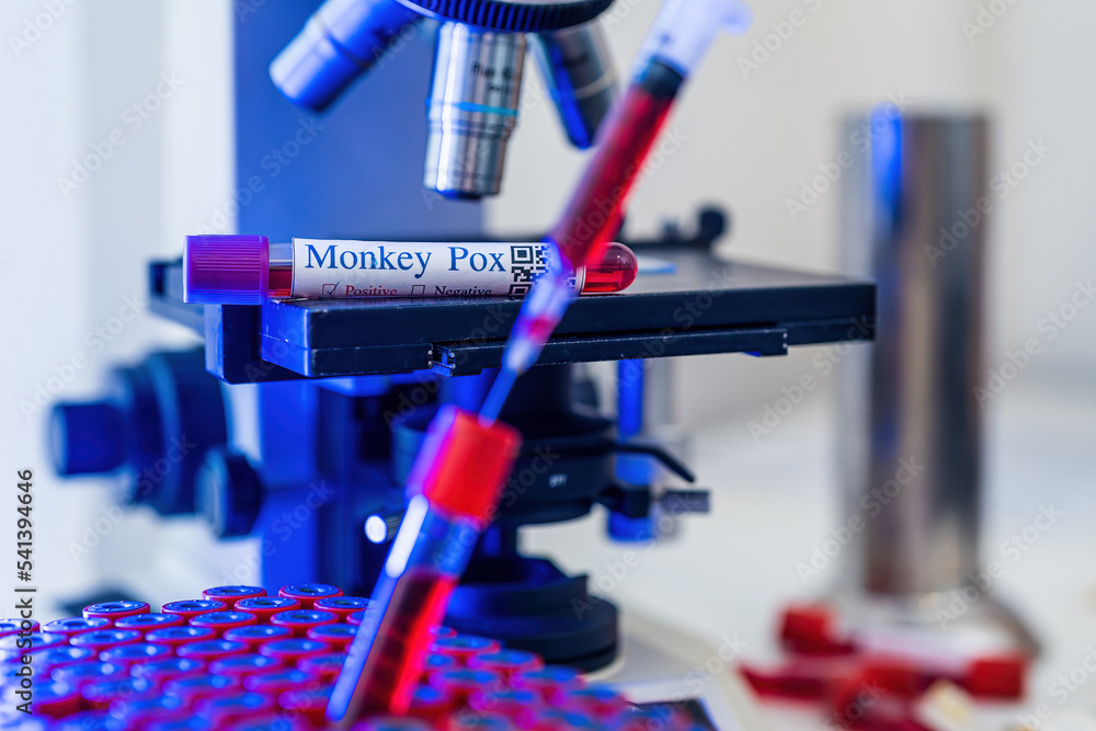 Foto Stock Blood test samples tube, reagent testing tube and swab ...