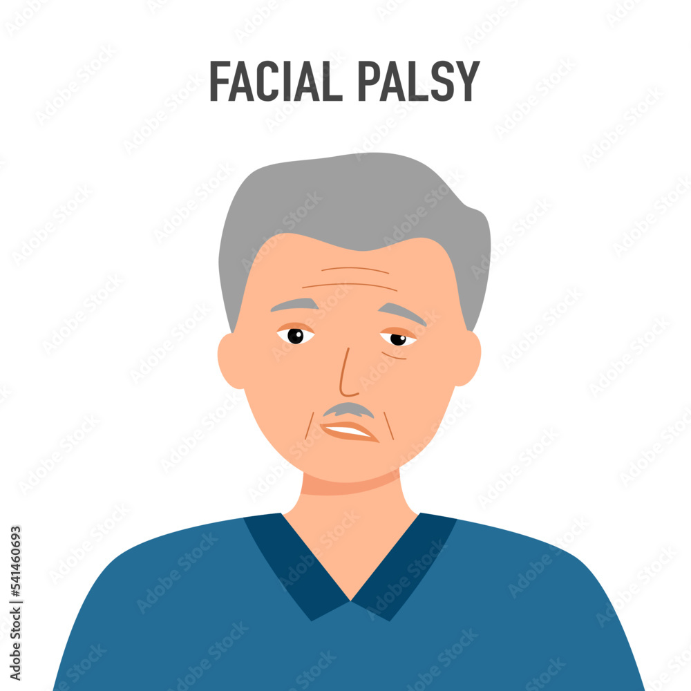 Senior facial nerve paralysis concept vector illustration. Face palsy ...