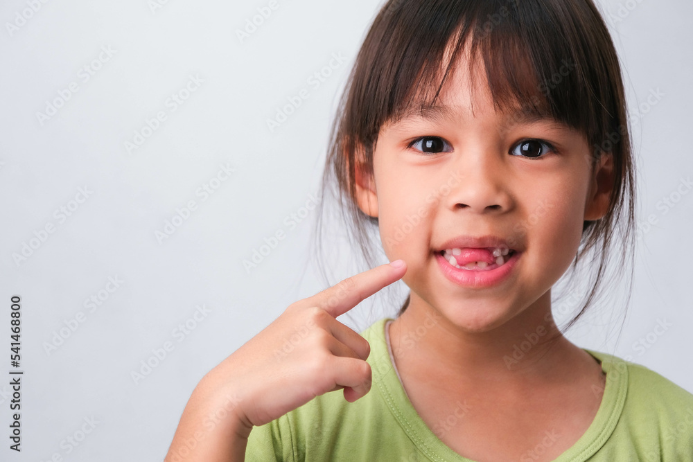 Portrait of an Asian girl with broken upper baby teeth and first ...
