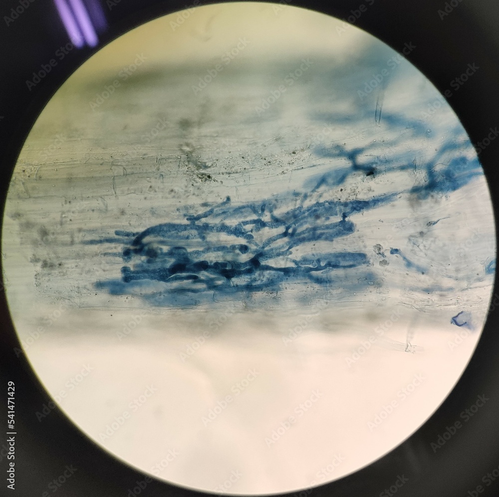 Real hyphae of mycorrhiza in root cell of plant under microscope foto ...