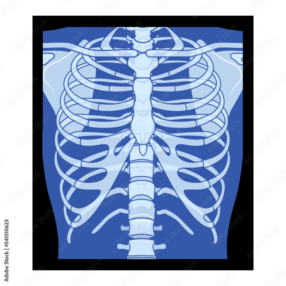 X-Ray Rib cage Skeleton Human body - chest, vertebra, Bones adult ...