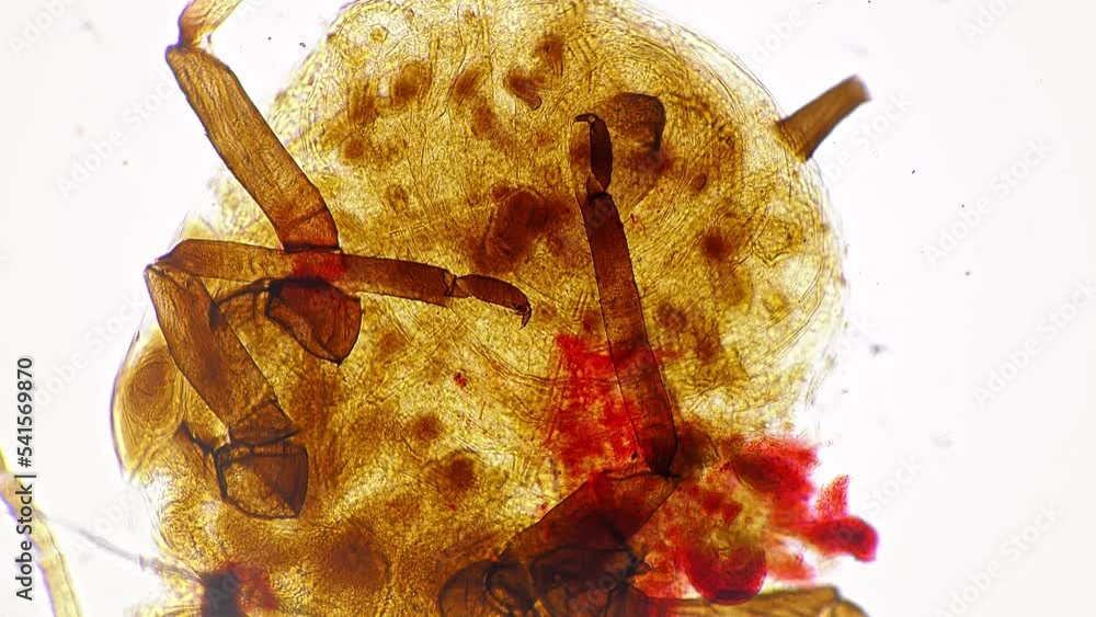 Body of aphis at microscopic slide 100x against white bright field ...