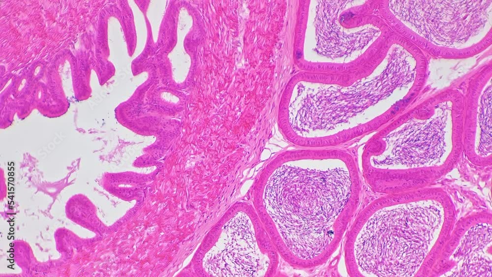Transversal section of testis shown under microscope and magnified in ...