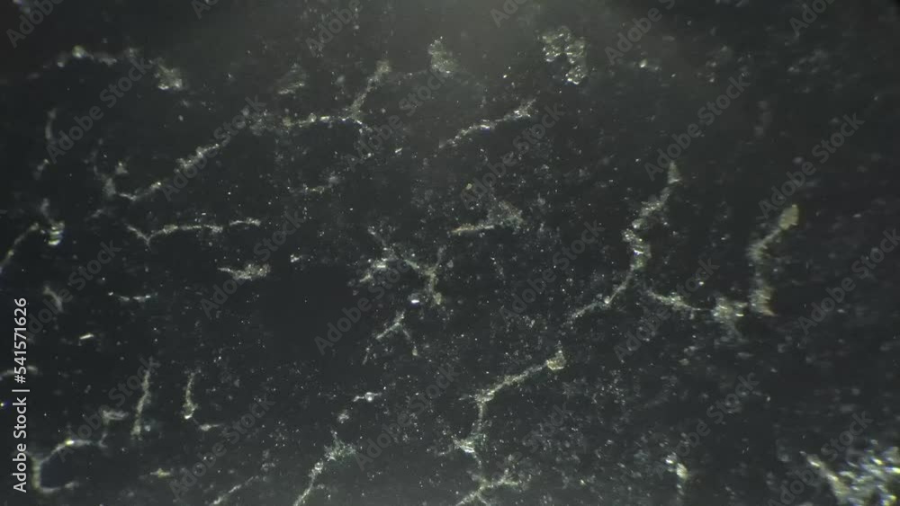 Eggs of Taenia solium whole mount magnified under microscope 40x filmed ...