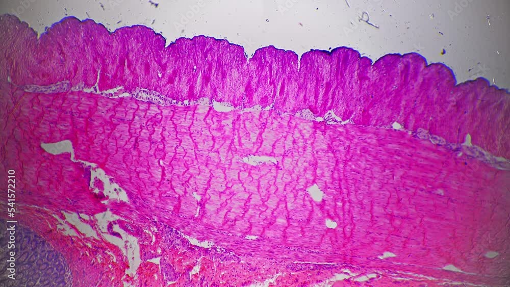 Transversal section of large intestinal under microscope 40x for ...