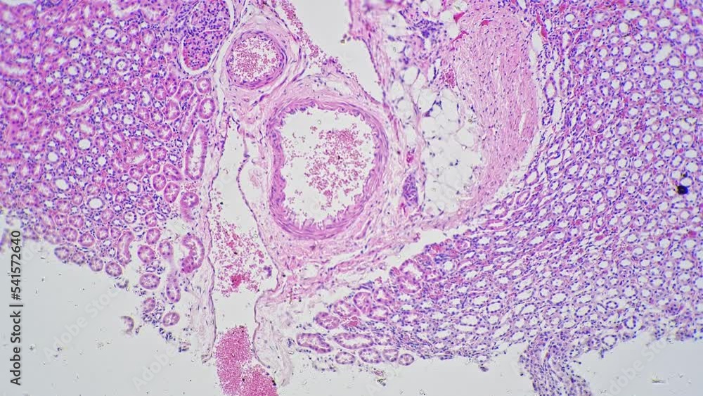 Artery and vein in section magnified under microscope 100x filmed on ...