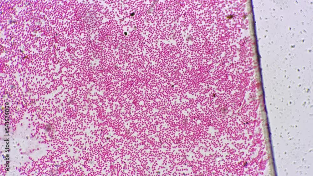 Chicken blood smear under microscope 100x against bright field ...