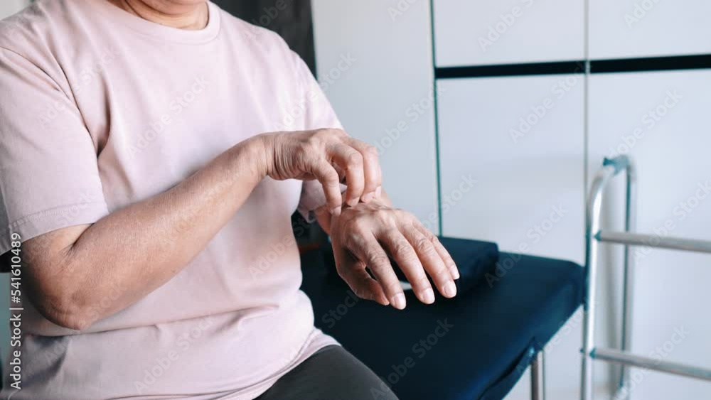 Elderly woman having rash or papule and scratch on hands from allergies ...