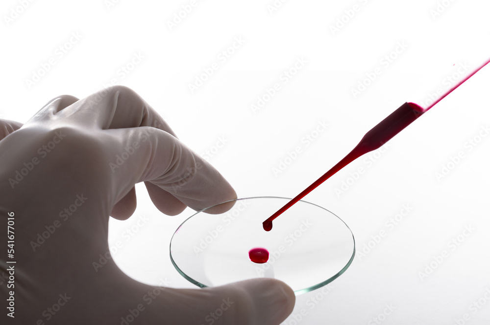 Researcher hand hold pipette and drops blood sample or red liquid onto ...