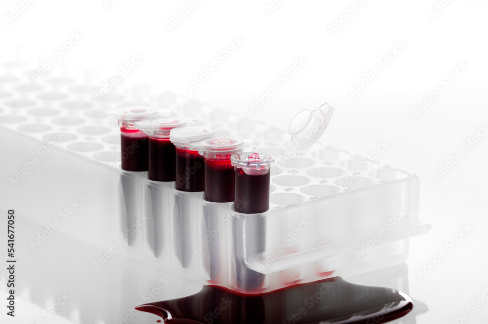 Broken blood sample PCR tube or red liquid on PCR plate in the ... Broken blood sample PCR tube or red liquid on PCR plate in the ...