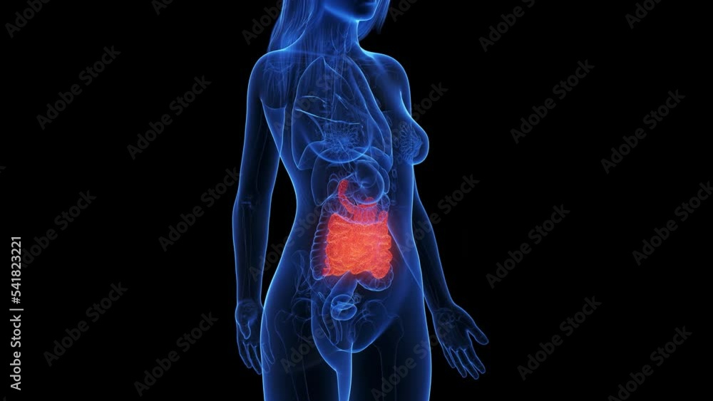 3d rendered medical animation of an inflamed small intestine Stock ...