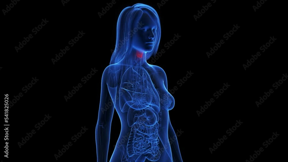 3d rendered medical animation of an inflamed larynx Stock Video | Adobe ...