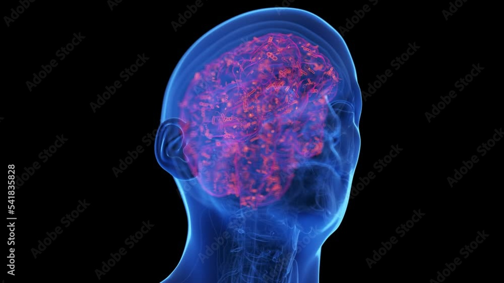 3d rendered medical animation of an infected human brain Stock Video ...