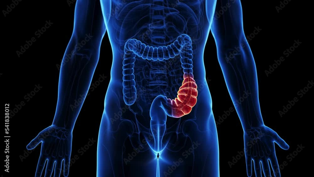 3d rendered medical animation of a constipation Stock-Video | Adobe Stock