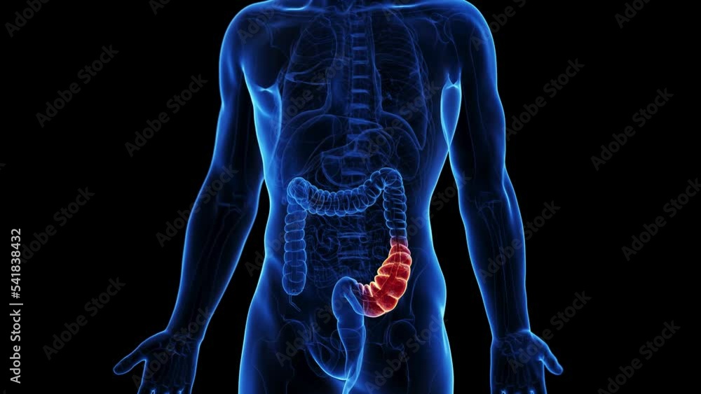 3d rendered medical animation of a constipation Stock ビデオ | Adobe Stock