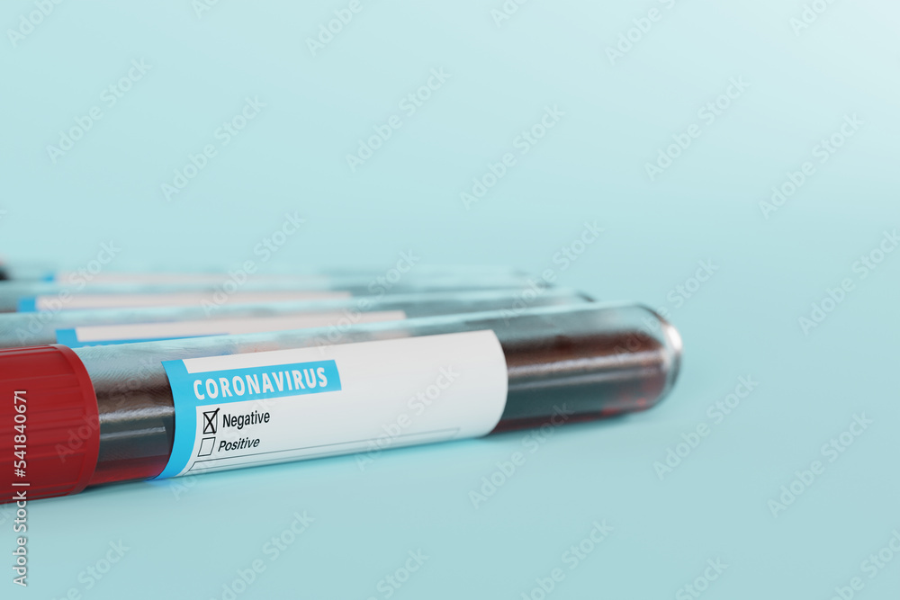 Blood samples for the Coronavirus COVID Test. The concept of the ...