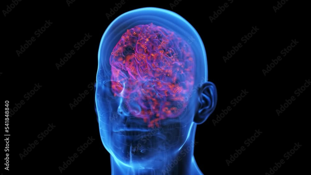 3d rendered medical animation of an infected brain Stock Video | Adobe ...
