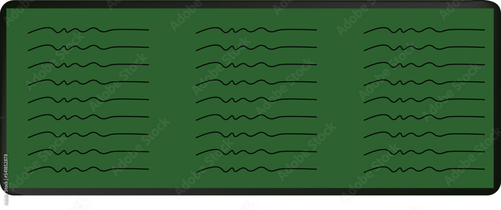 whiteboard blackboard greenboard black board shool tools green screen ...