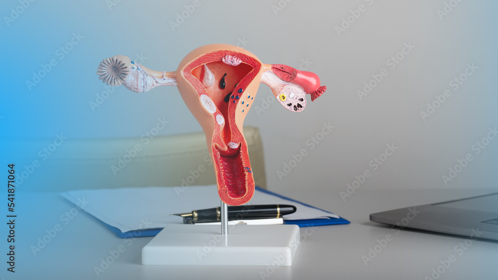 model of female reproductive system and stethoscope lies on a blue ...