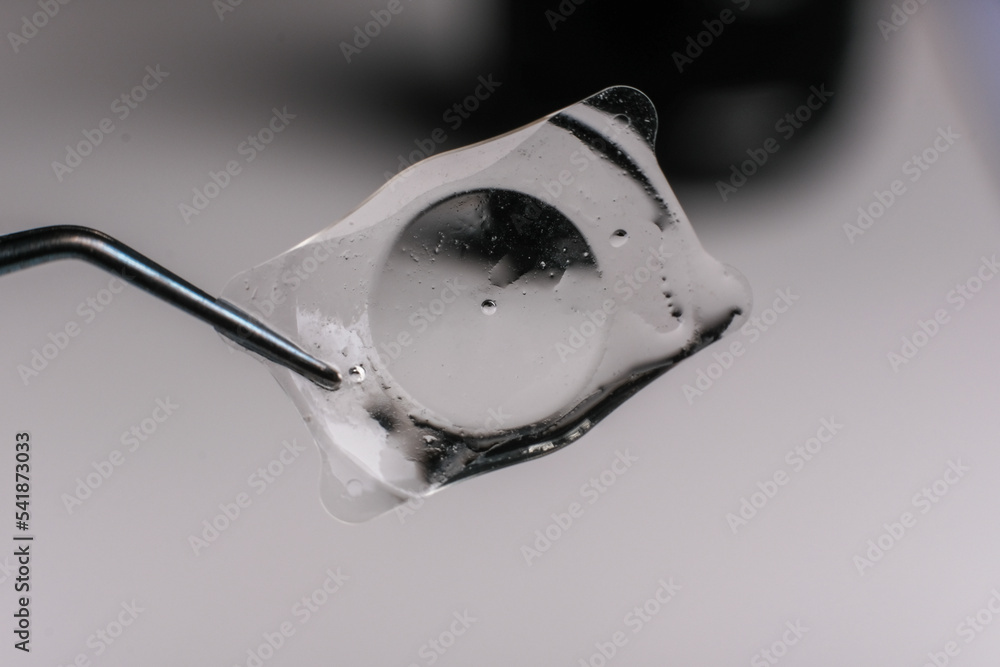 closeup photo of real eye lens removed from human suffering from ...