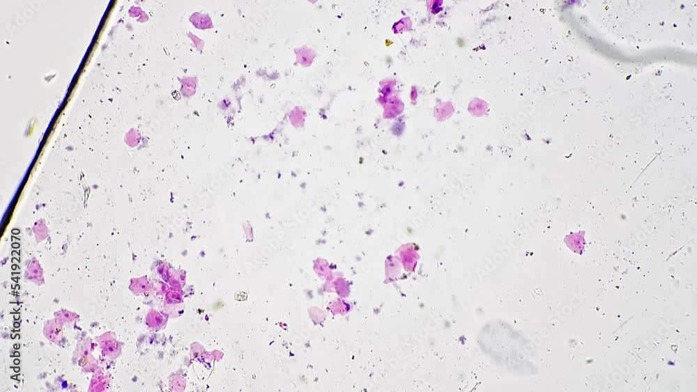 Epithelium cells of cavitas oris of human whole mount under microscope ...