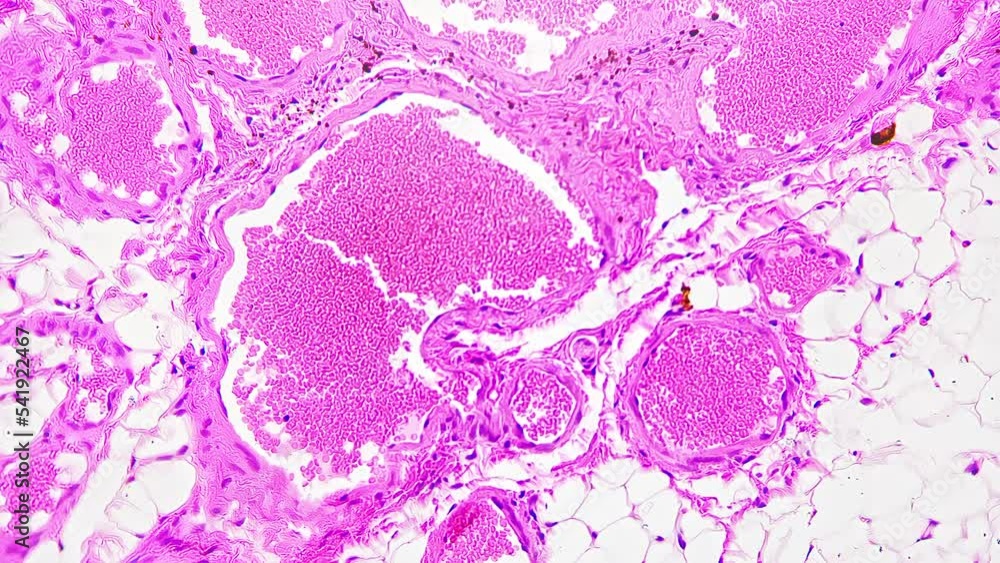 Intestine in longitudinal section magnified under microscope in 200 ...