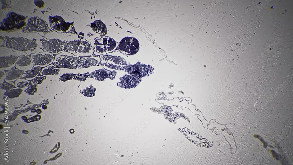 Meiosis of grasshopper in section under microscope magnified in 40 ...