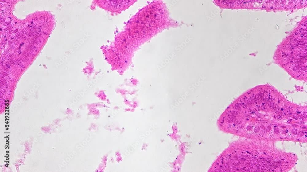 Transversal section of testis shown under microscope and magnified in ...