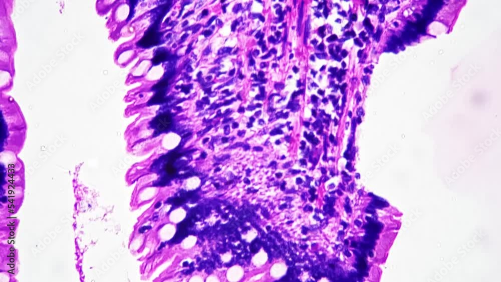 Large intestinal in transversal section filmed under microscope 400x ...
