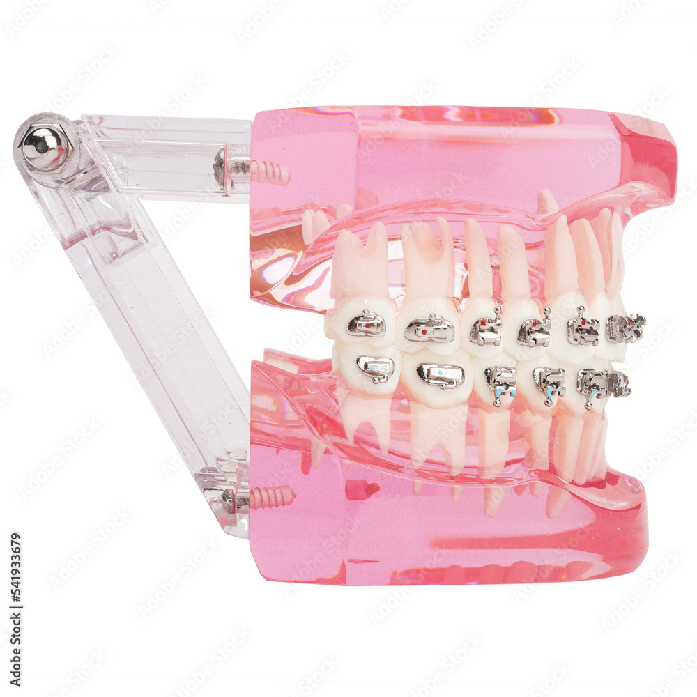 Demonstration teeth with roots model of orthodontic bracket or brace ...
