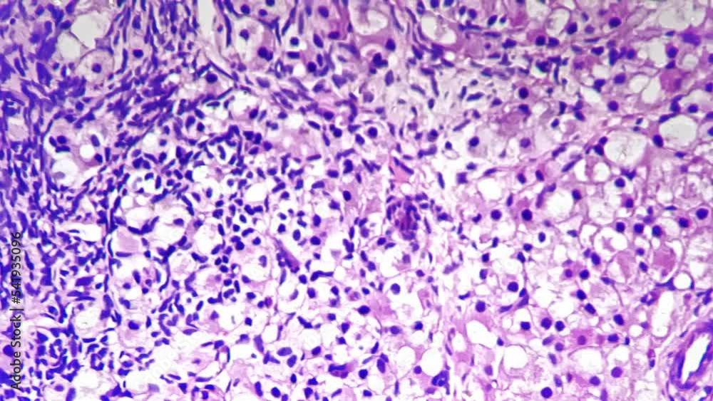 Ovary in section magnified under microscope 400x against bright field ...