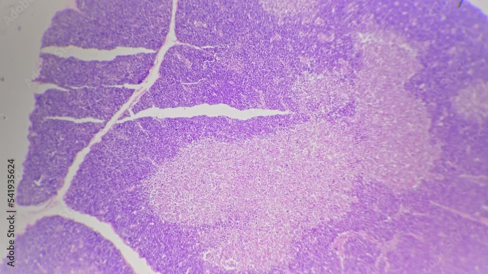 Thymus in transversal section magnified under microscope in 40 times ...