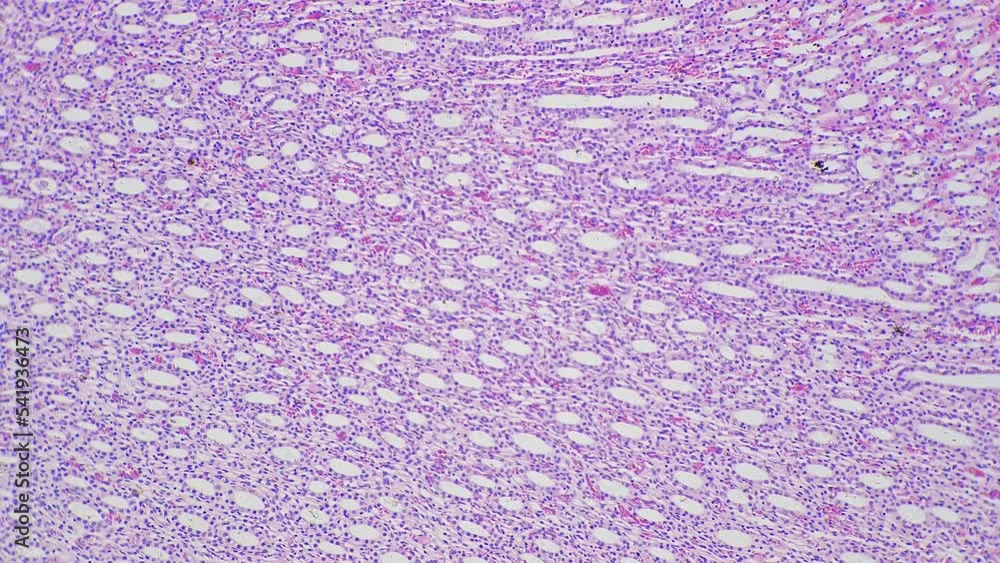 Artery and vein in section magnified under microscope in 200 times ...