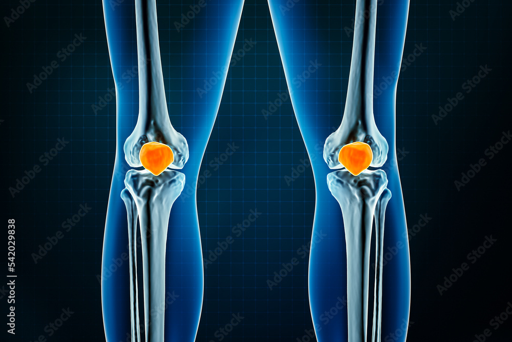 Patella or kneecap bone x-ray front or anterior view. Osteology of the ...