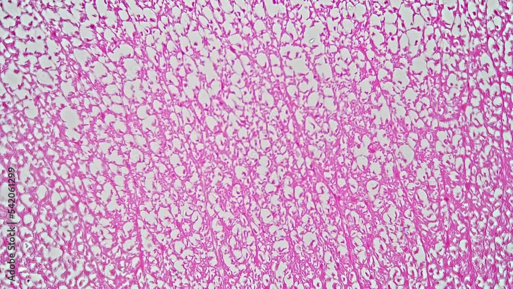 Spinal cord cell TS microscopic sample 400x magnification tinted pink ...