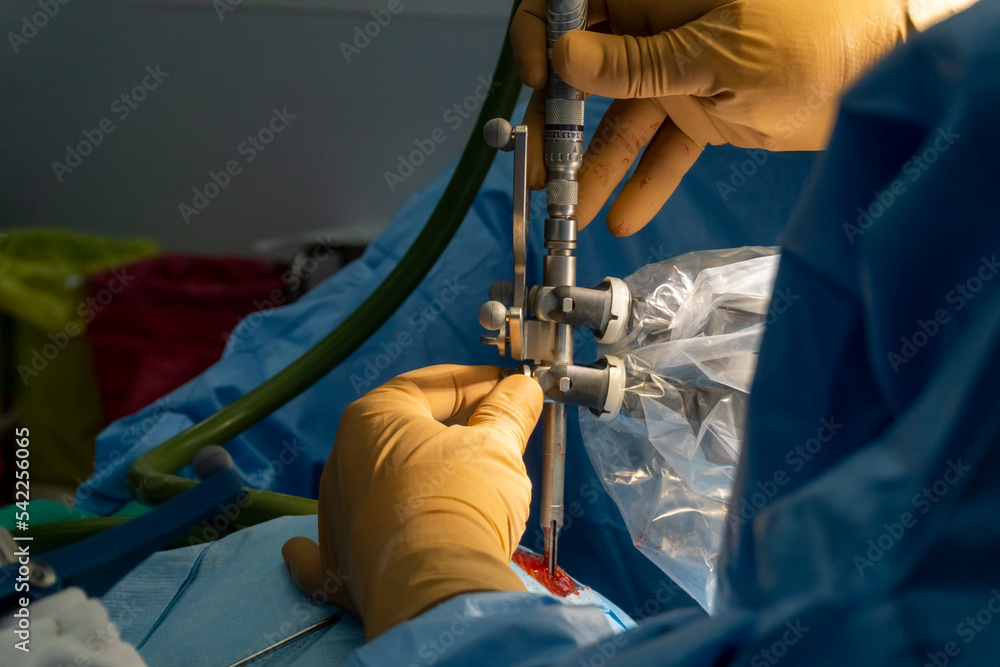 Step by step Visualase is an MRI-guided laser ablation system used to ... Step by step Visualase is an MRI-guided laser ablation system used to ...