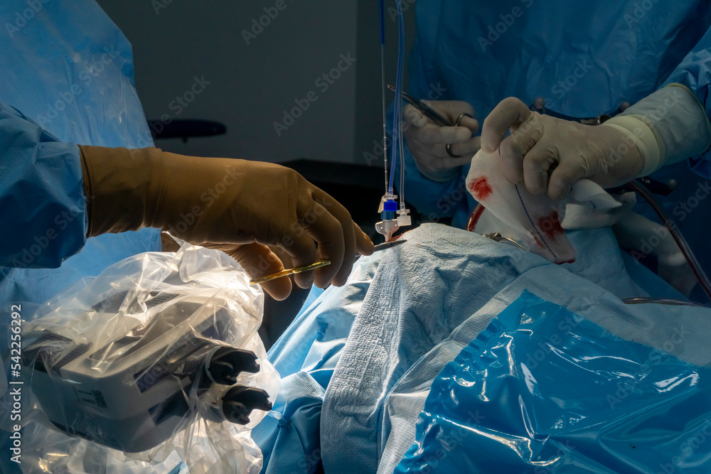 Step by step Visualase is an MRI-guided laser ablation system used to ... Step by step Visualase is an MRI-guided laser ablation system used to ...