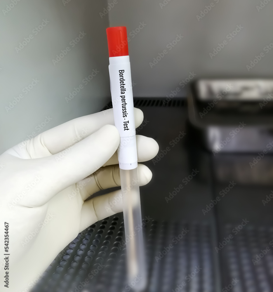 Bacteriologist holding swab sample for Bordetella pertussis bacteria ...