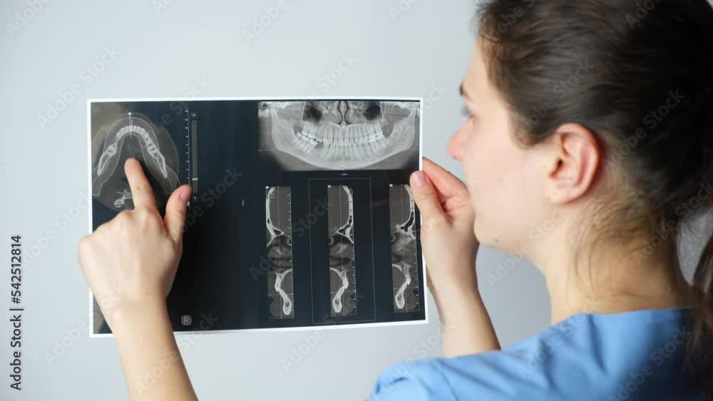 Doctor showing a CT scan of a patient with temporomandibular joint ...