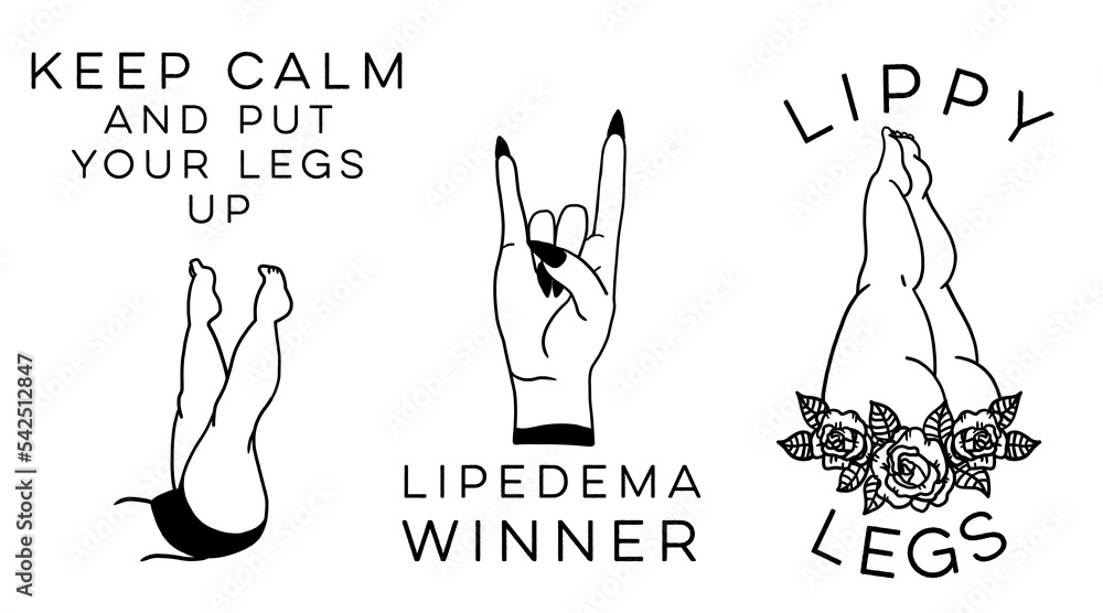 Lipedema Awareness illustrations, set of drawings, fat disorder ...