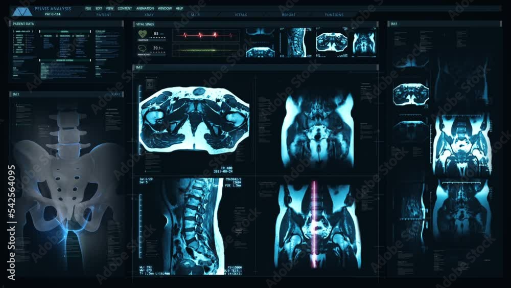 Medical Profile of Patient Showing Pelvis MRI Scan, 3D Pelvis Bone ...