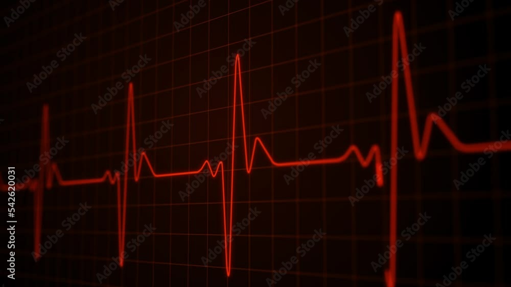 Patient monitor displays vital signs ECG electrocardiogram EKG, oxygen ...